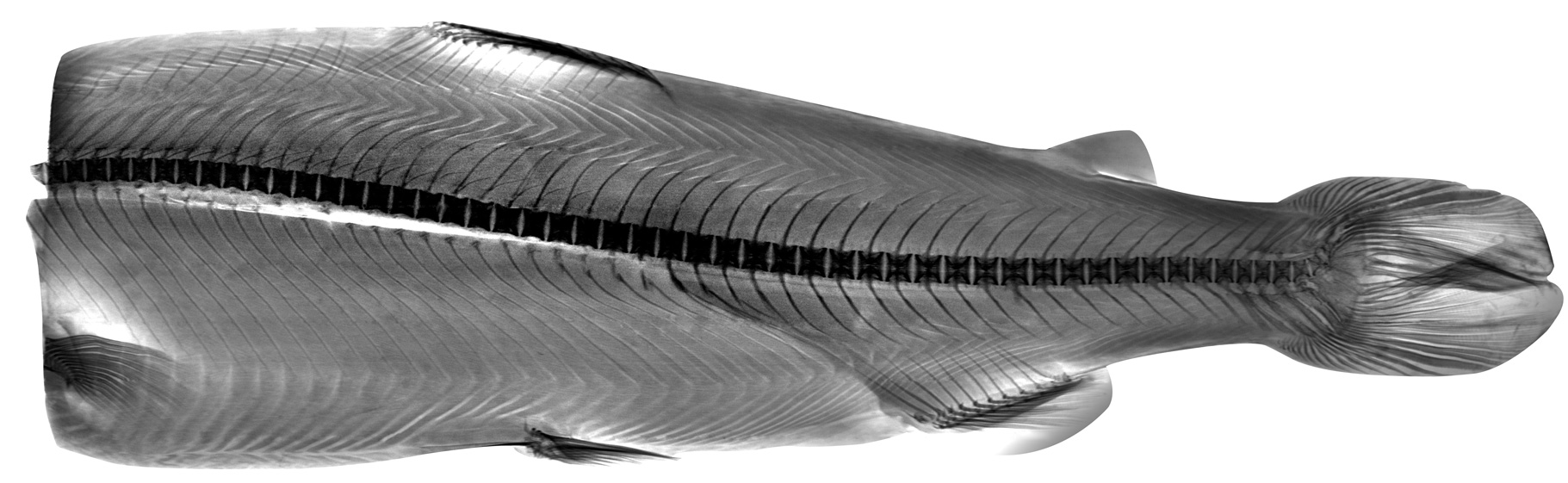 Game-changing technology for fishbone detection